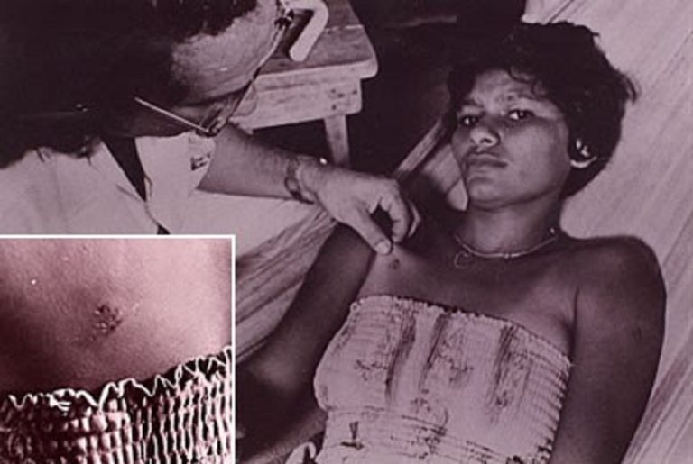 The 1977 Colares Island Incident - UFO Insight